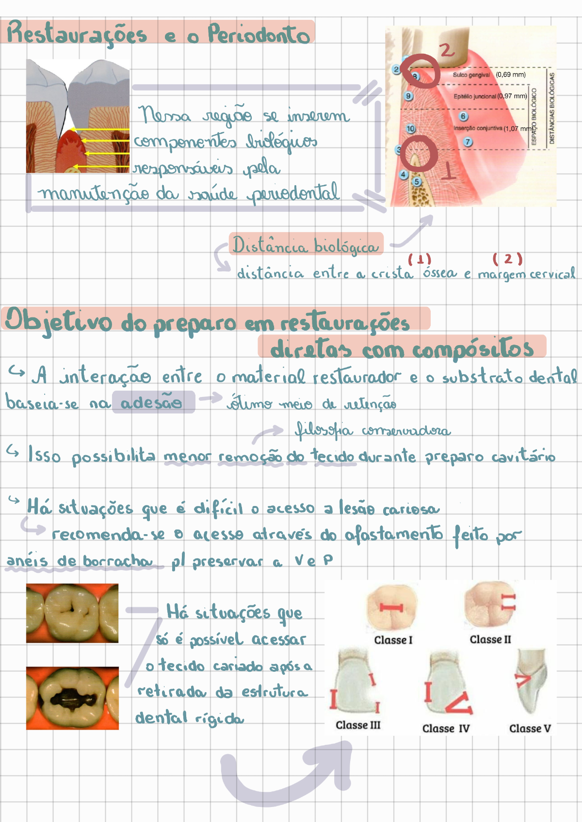 Princípios gerais do preparo cavitário - Odontologia
