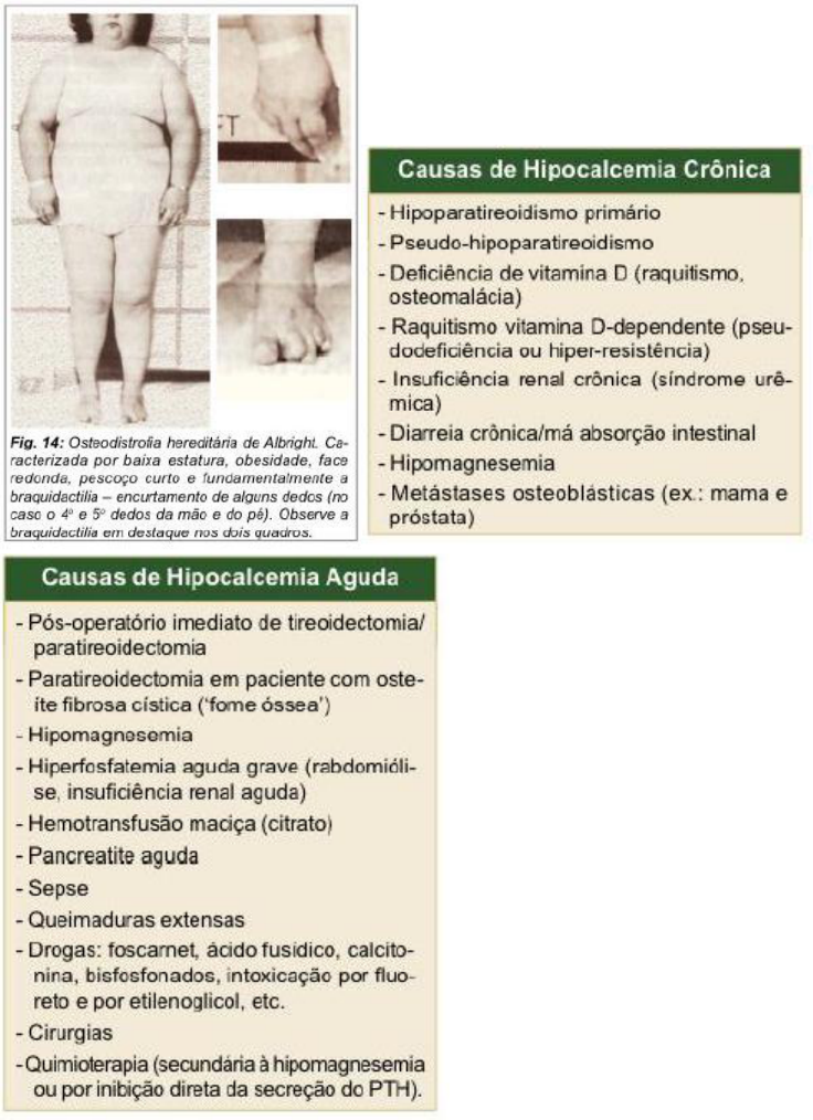 Pseudopseudo Hipoparatireoidismo Hypoparathyroidism : Definition,