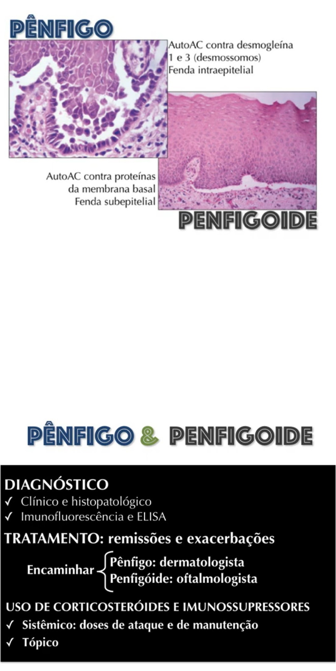 Penfigoide Vs Penfigo