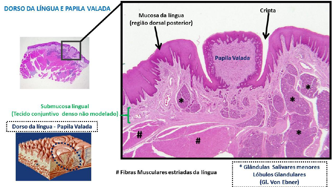 Histologia Das Tonsilas Linguais