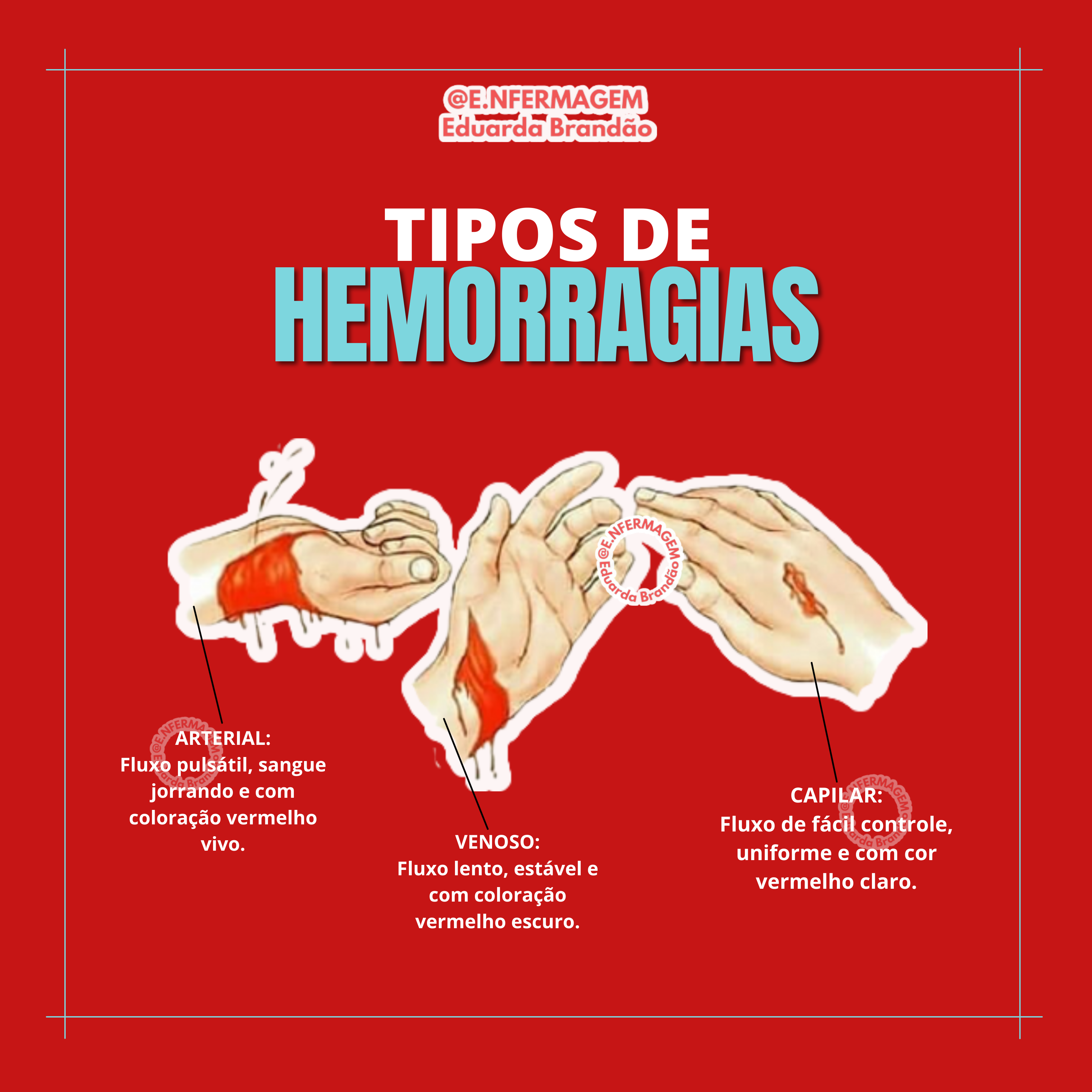 Tipos de hemorragia - Enfermagem