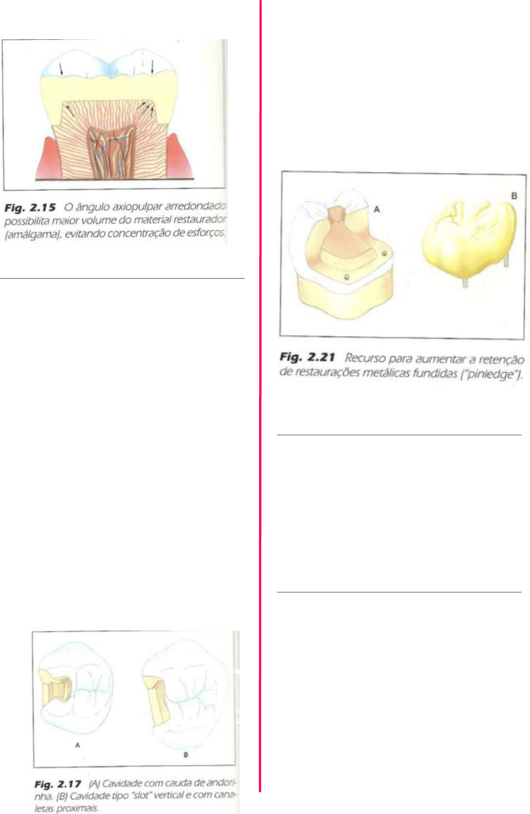PRINCÍPIOS GERAIS DO PREPARO CAVITÁRIO - Dentística