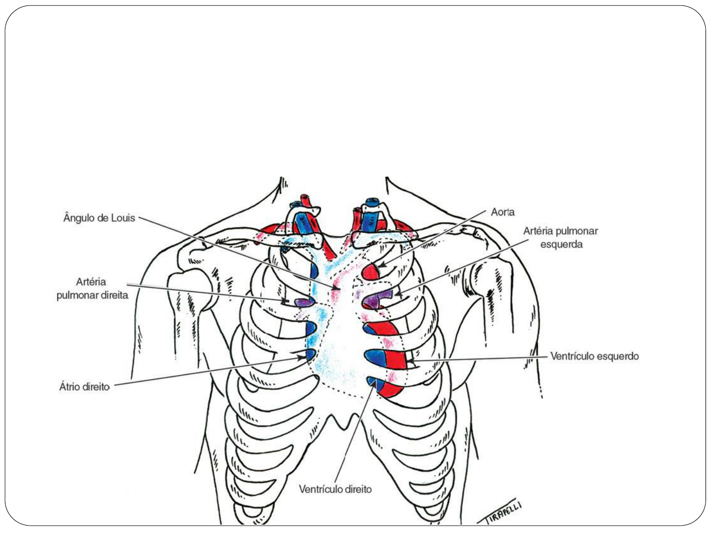 Exame Físico do Precórdio - monitoria - Semiologia Médica
