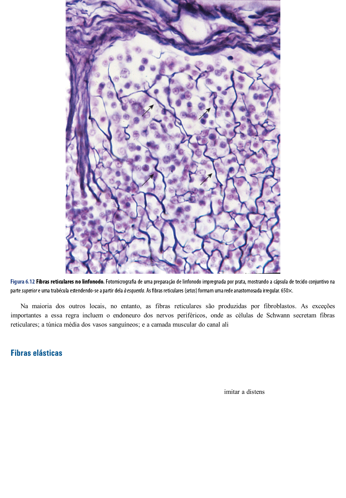 Tecido Reticular Sob Microscopio