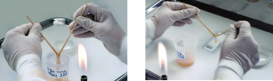 Baciloscopia preparação do esfregaçorevisado - Microbiologia