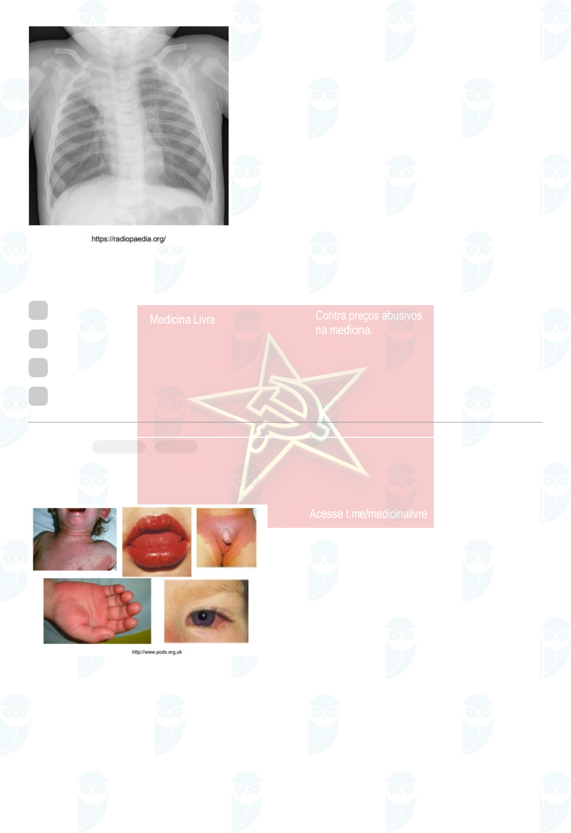 Anatomia Venosa Membro Inferior Radiopaedia Radiology - Infoupdate.org