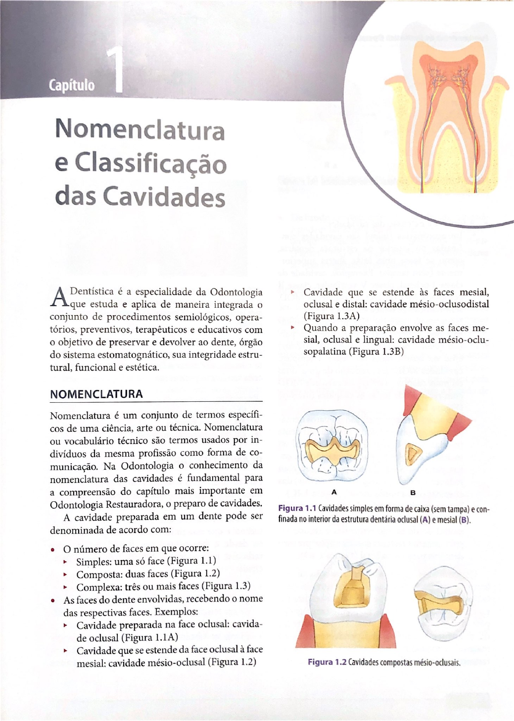 Nomenclatura E Classificação Das Cavidades - RETOEDU