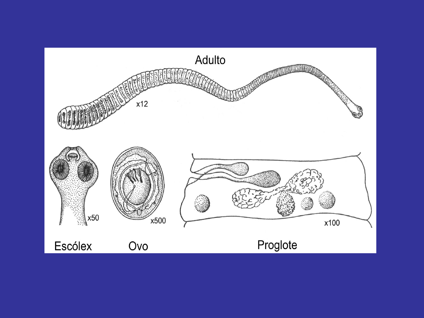 Hymenolepis Nana Cisticercoide