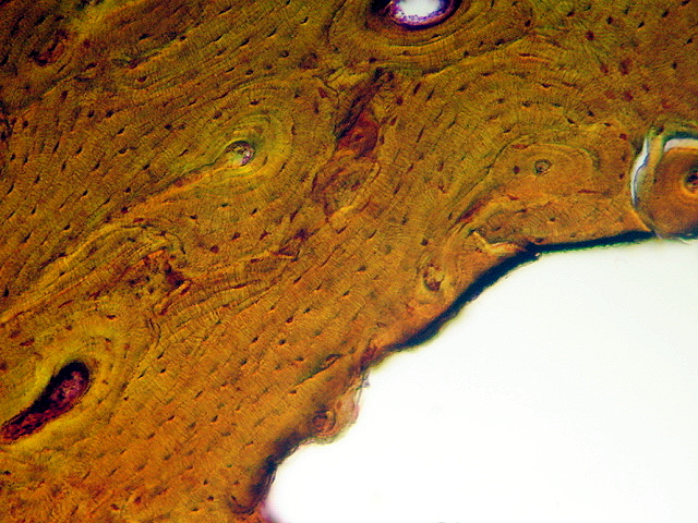 Lâmina 26 8 (lamelas concentricas internas) - Bioquímica Celular