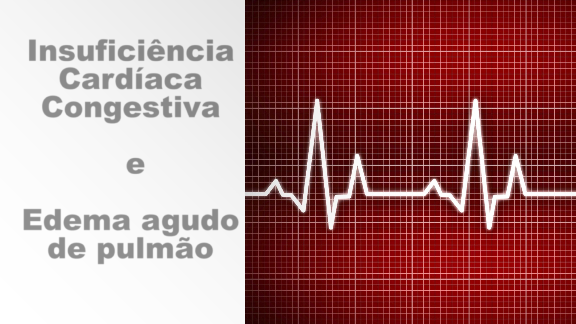 Aula 7 Insuficiência Cardíaca e Edema Agudo de Pulmão - Medicina