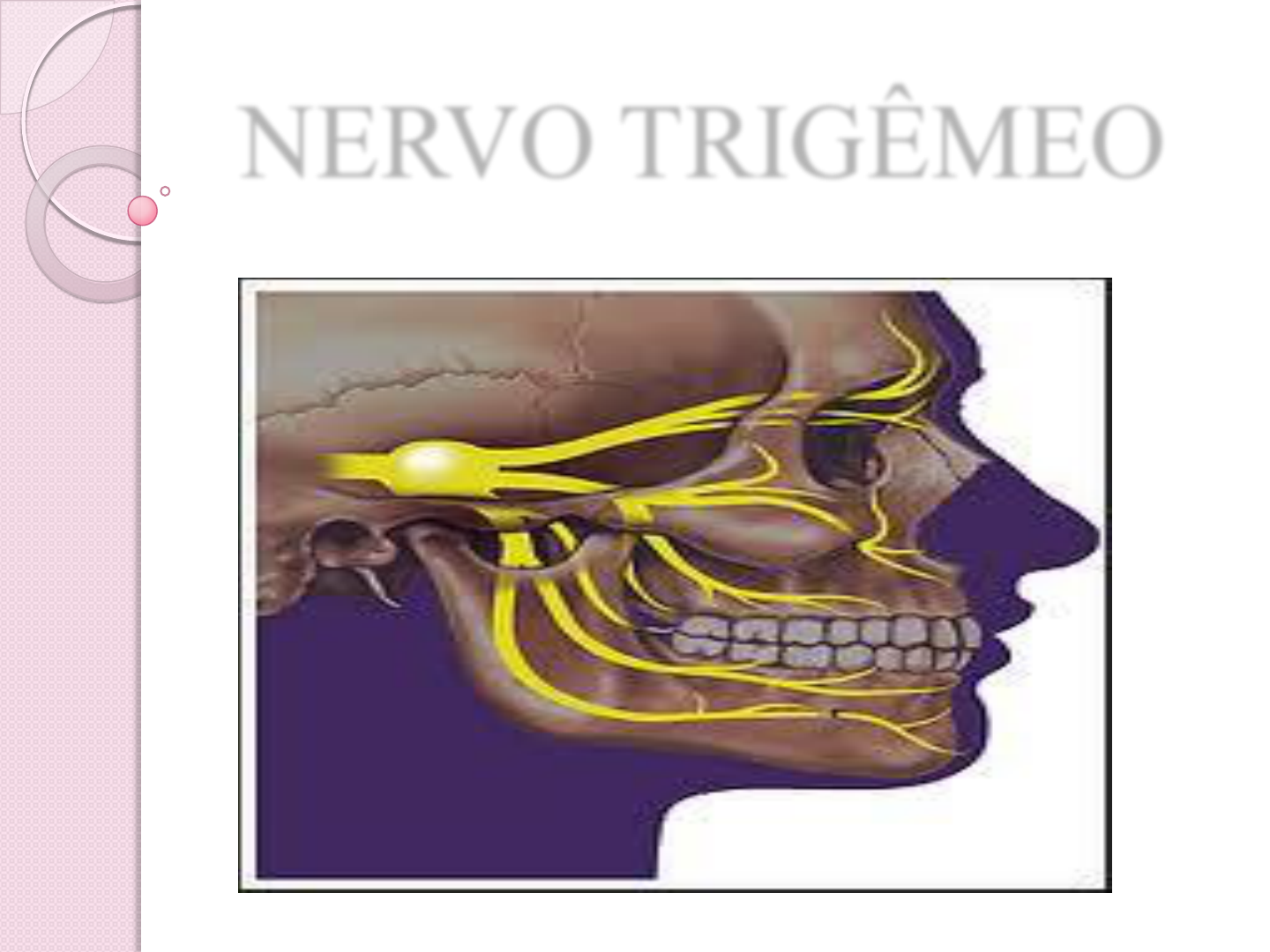 NERVO TRIGÊMEO - Cirurgia Buco-maxilo-facial