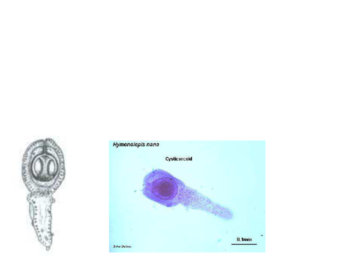 Hymenolepis Nana Cisticercoide