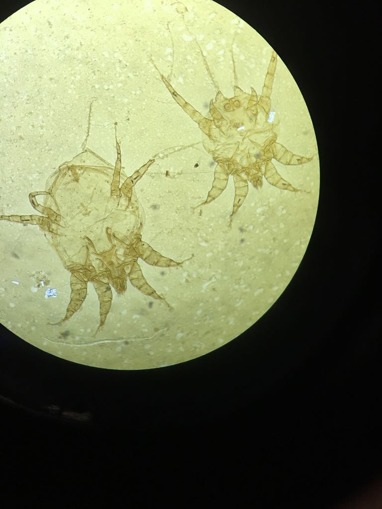 Psoroptes equi femea e macho - Artropodes