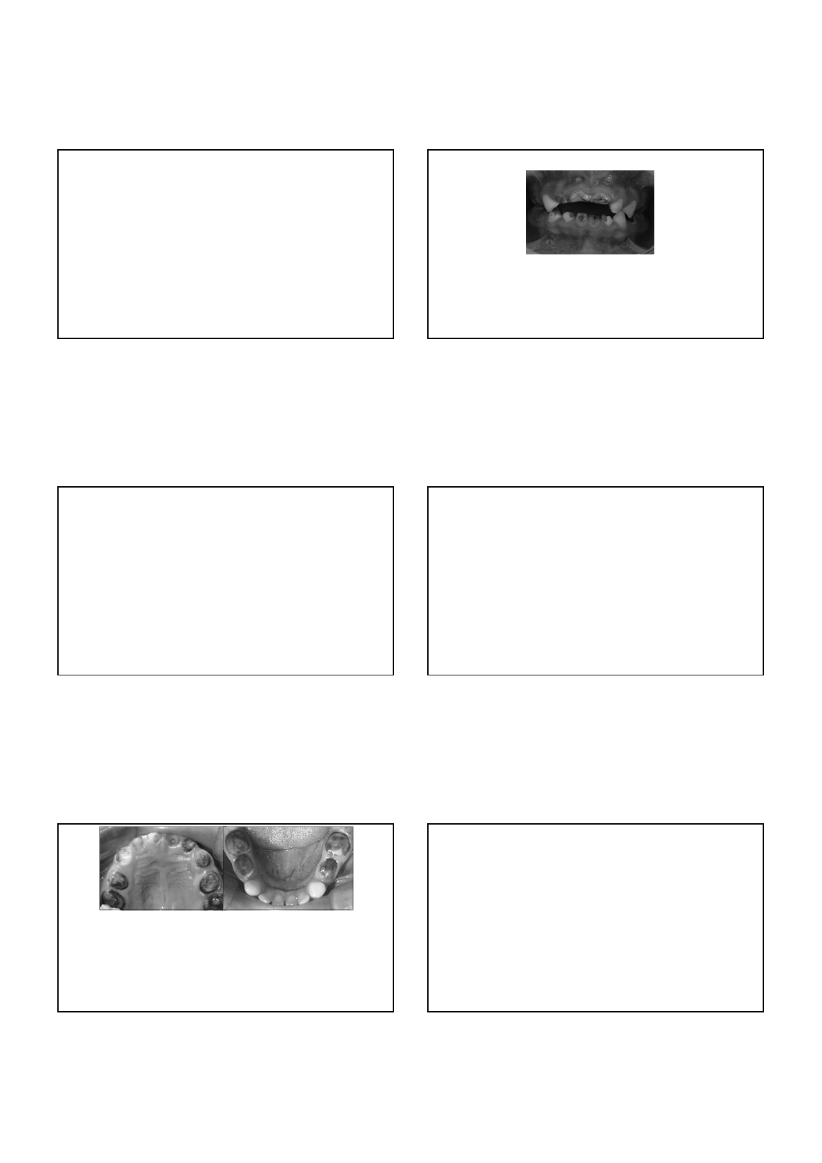 cariologia - Dentística