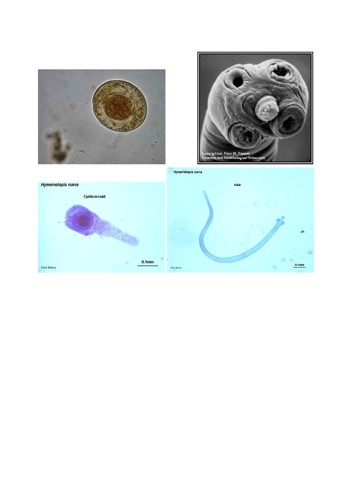 Hymenolepis Nana Cisticercoide