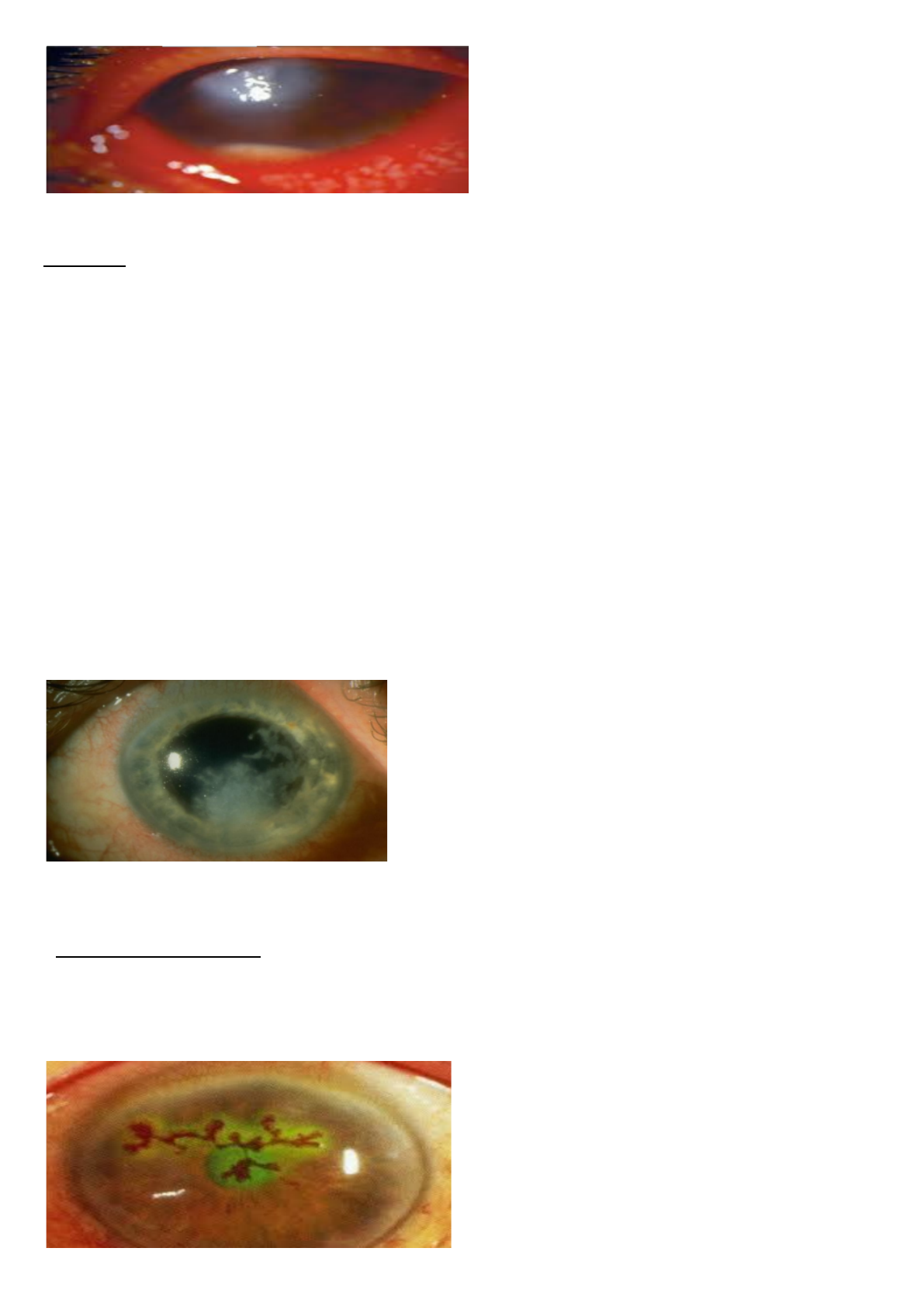 Ceratopatia Lipidica PDF) Bilateral Corneal Arcus In Canine