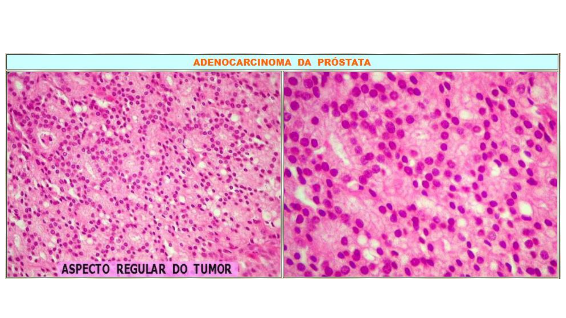 Histologia Da Prostata Próstata: Anatomia E Histologia | Kenhub