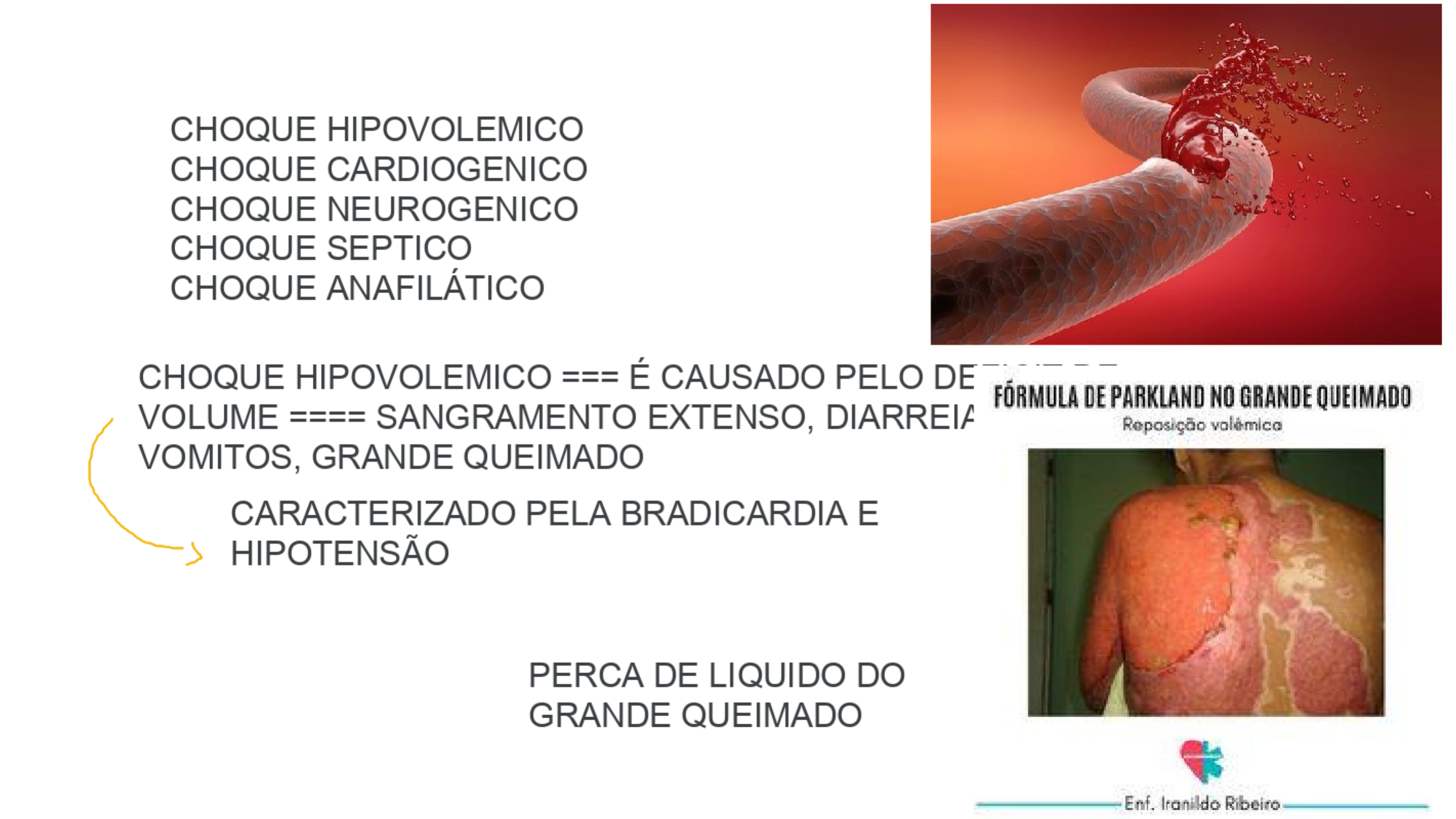 CHOQUES cardiopulmonar - Cardiologia I