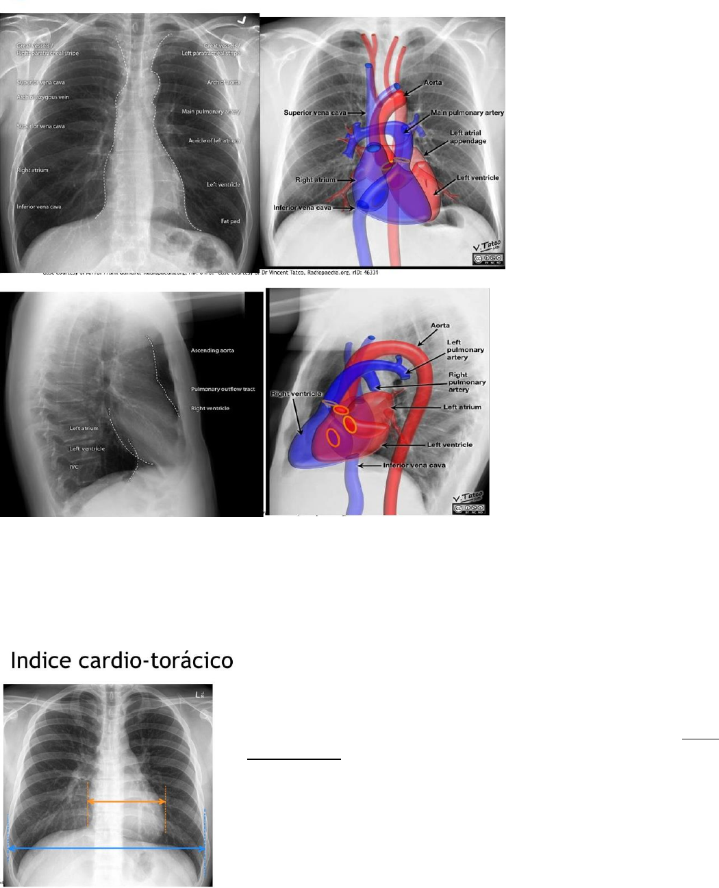Anatomia Venosa Membro Inferior Radiopaedia Radiology - Infoupdate.org