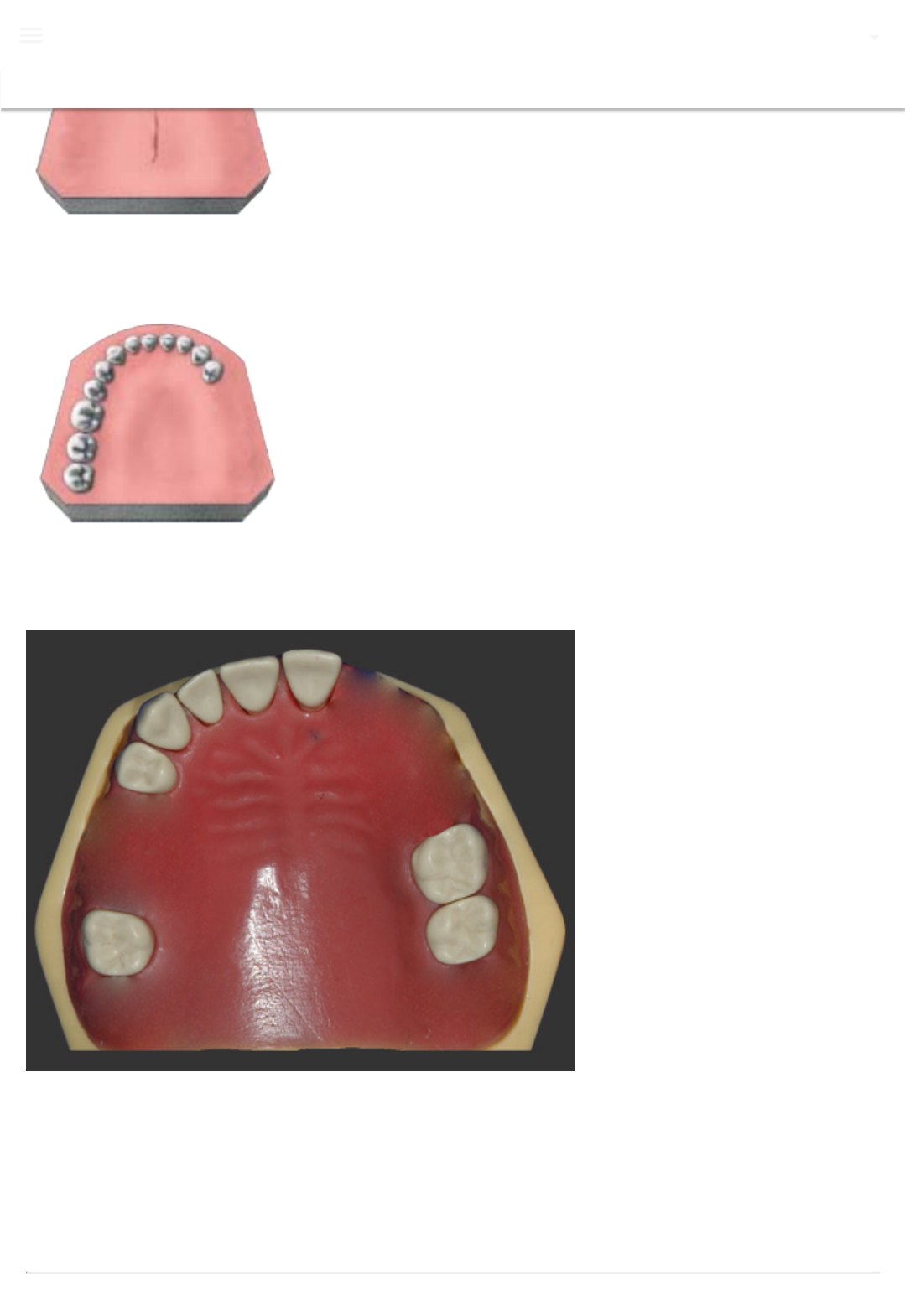 Classificação de Kennedy - Ortodontia Preventiva