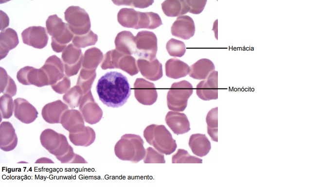Histologia De Monócitos