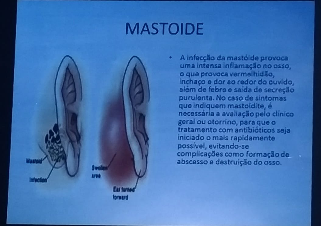 mastóide - Anatomia Radiológica