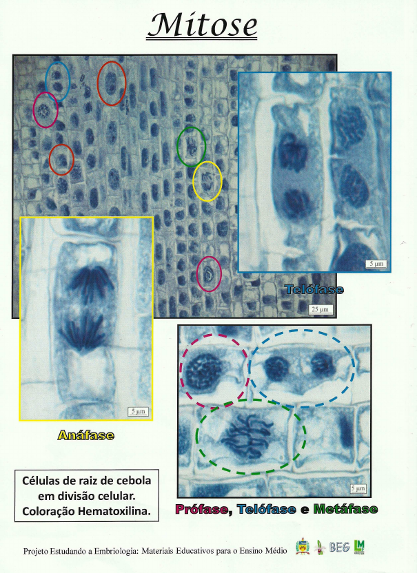Fases Do Ciclo Celular Da Raiz Da Cebola Foto De Ponta De Raiz De