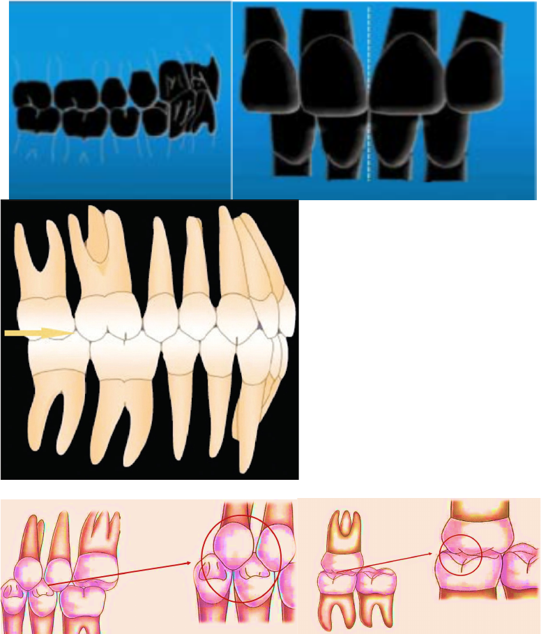GUIA DE ESTUDOS As 6 chaves de Andrews 2017 2 - Ortodontia