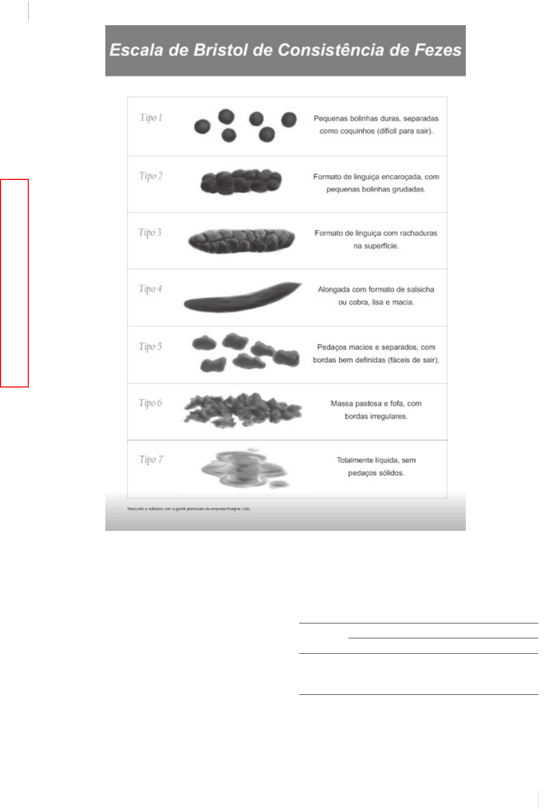 Escala de Bristol: o que é e como identificar problemas digestivos