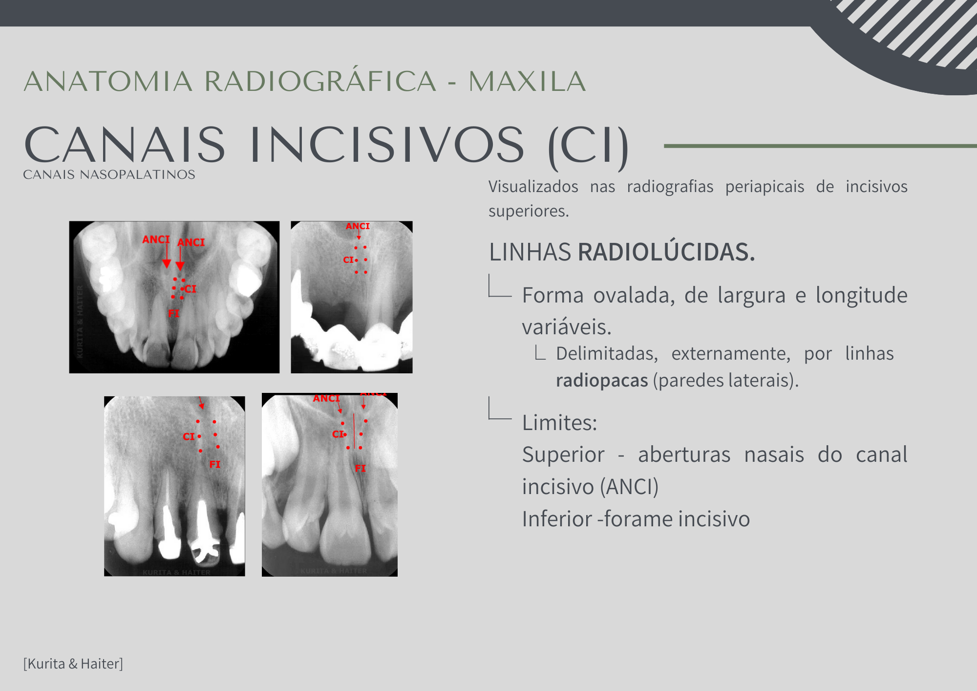 Anatomia Radiográfica - Canais Incisivos - Radiologia Odontológica