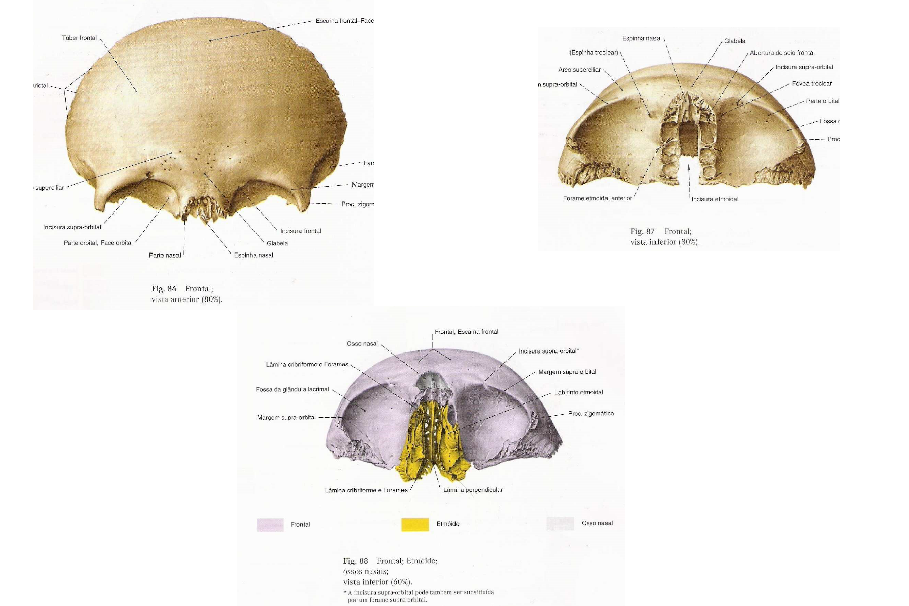 10 OSSOS DO CRÂNIO FRONTAL - Anatomia Humana I