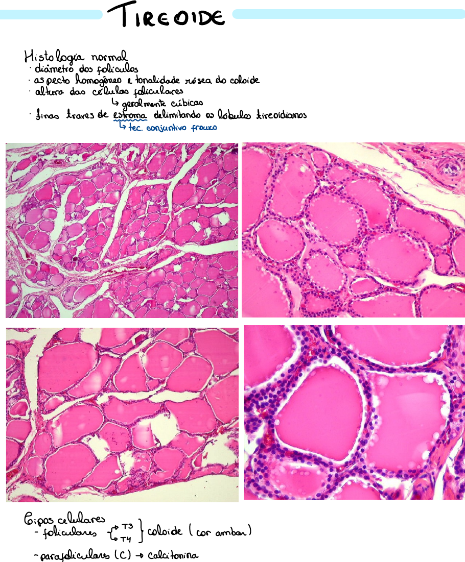 Patologia Tireoide e Paratireoides - Endocrinologia