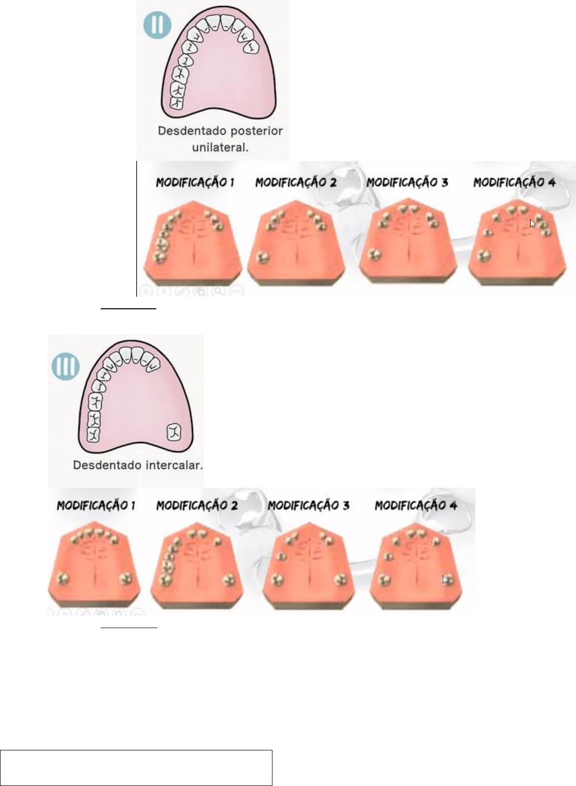 ATUALIZADO - 00 Classificações Kennedy, Applegate e Rumple -Prótese ...