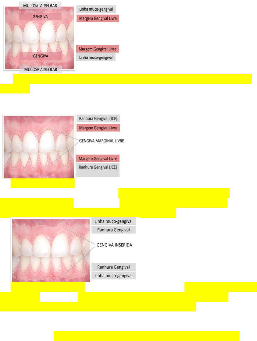Histologia De Gengivite Ulcerativa Necrosante