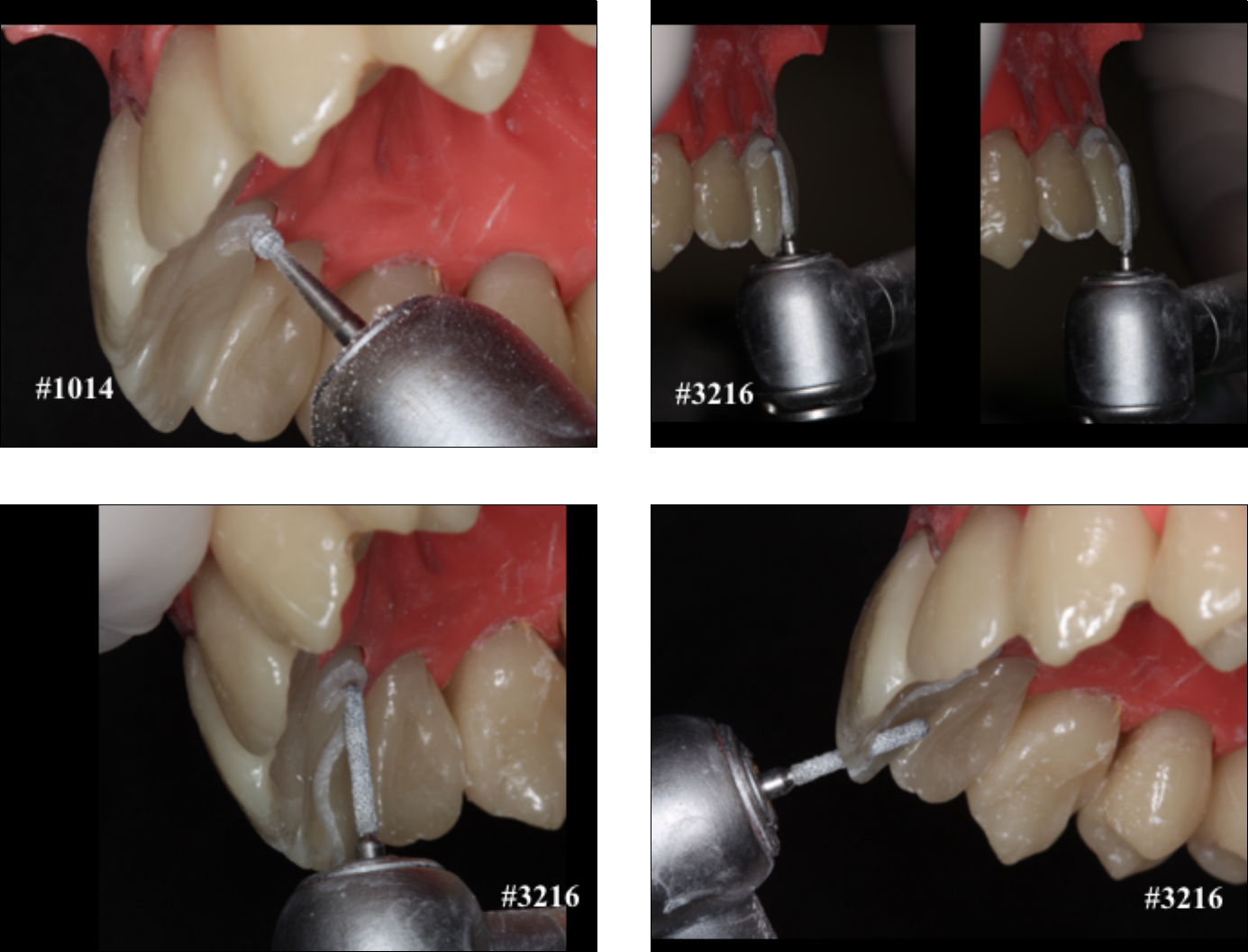 Preparos Protéticos - Odontologia Restauradora