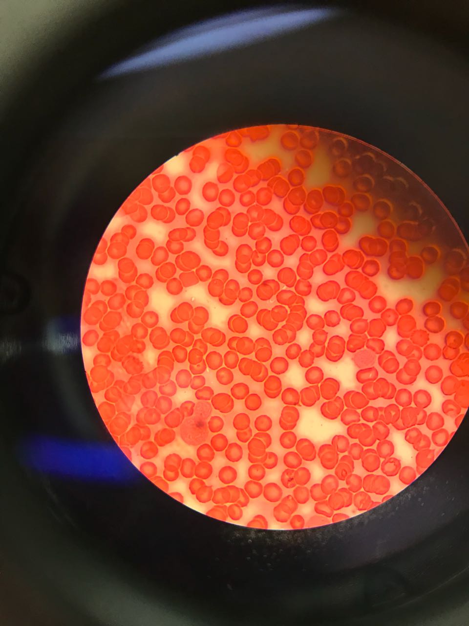 Microscopia- Celulas sanguineas - Biologia Celular