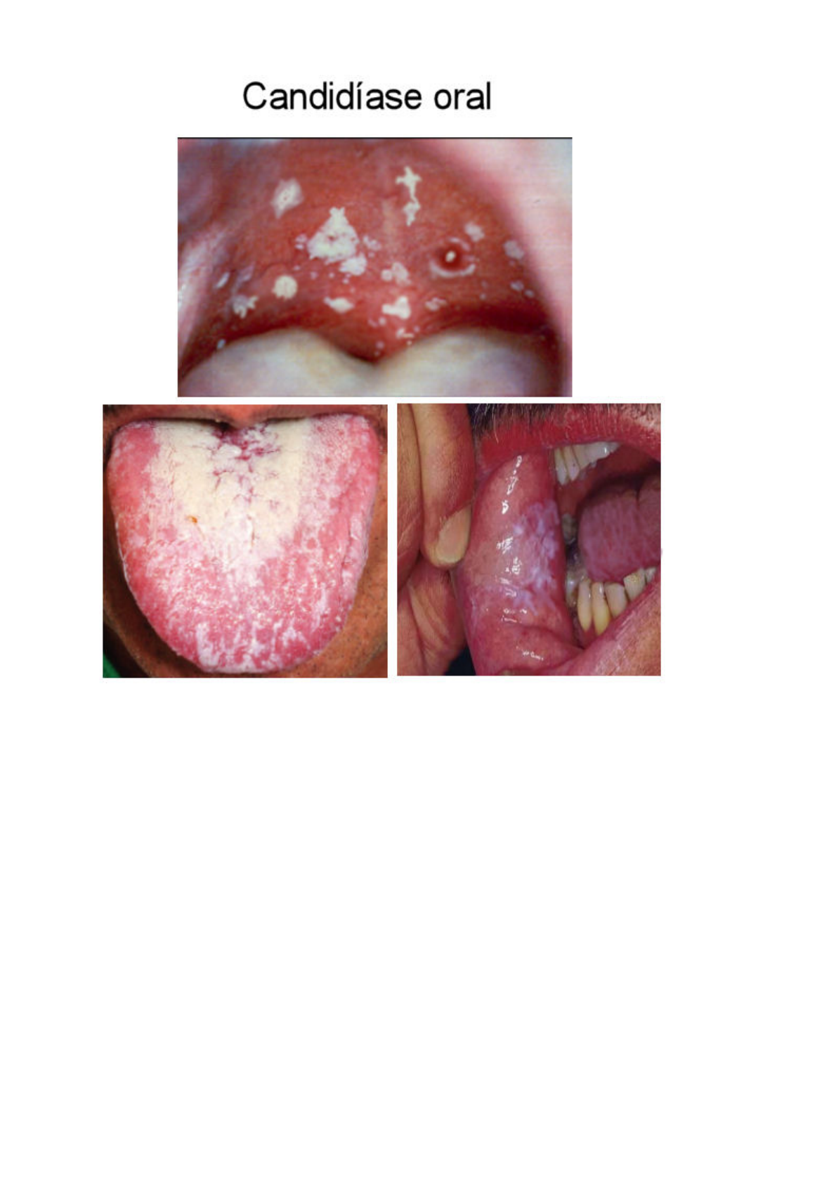 Como E A Clamidia Na Boca