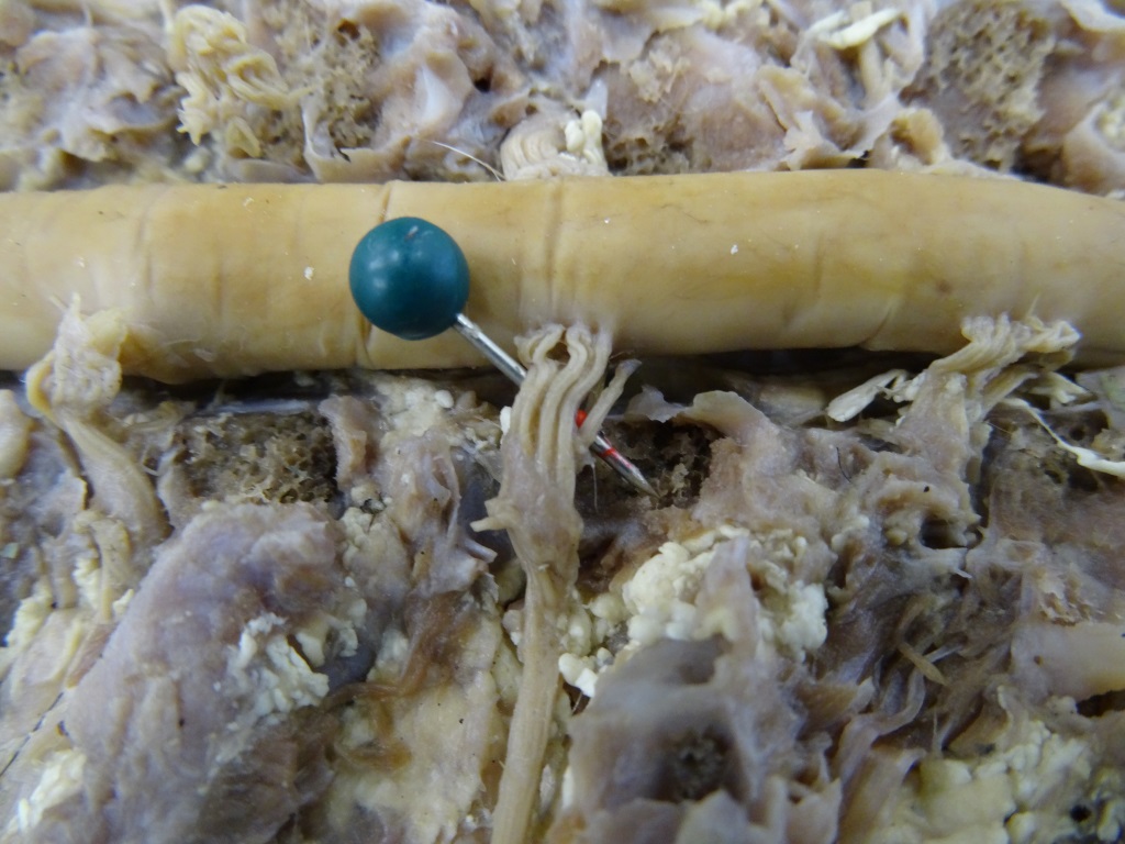 medula espinhal (11) - Anatomia Veterinária I