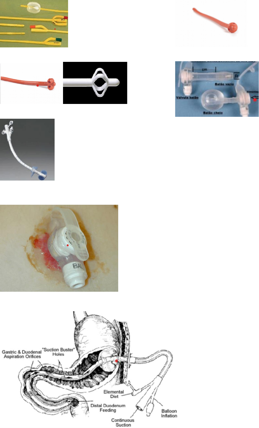 Grátis: GASTROSTOMIA E JEJUNOSTOMIA - CIRURGIA - Material Claro e ...