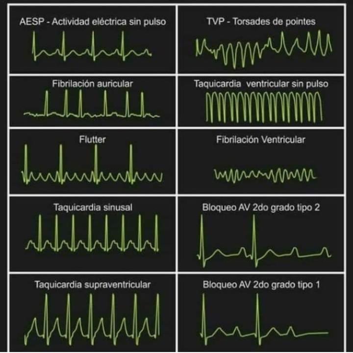 RITMOS CARDIACOS - Anatomia I