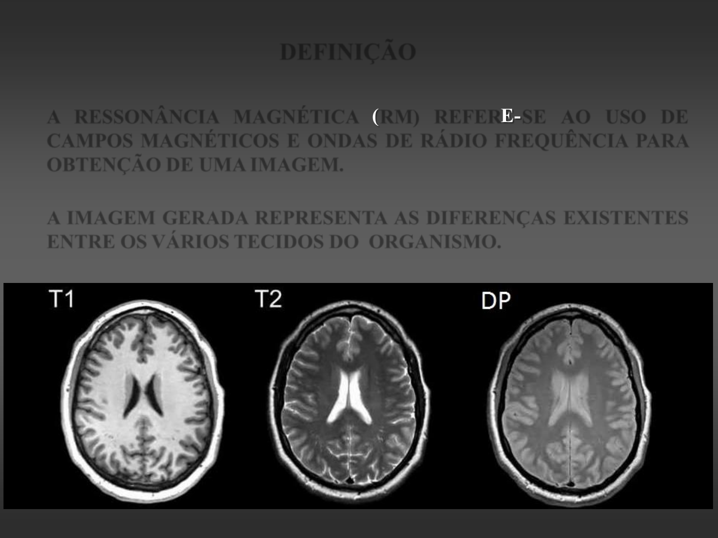 PRINCÍPIOS FÍSICOS EM RMN 26 08 2022 - Ressonância Magnética