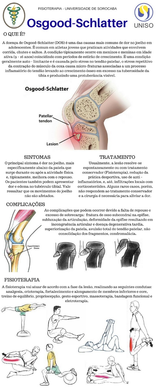 Exercicios Para Doenca De Osgood Schlatter