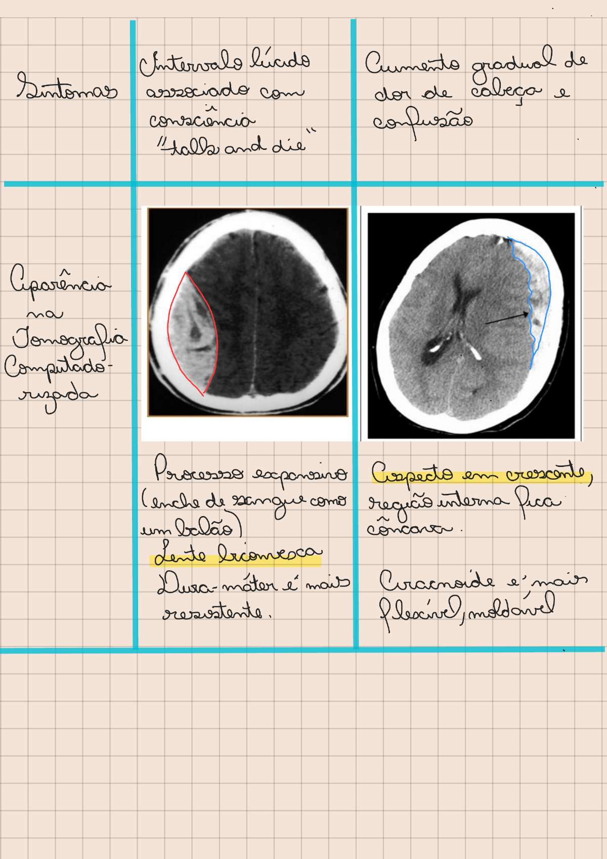 Hematomas epidural X subdural - Patologia I
