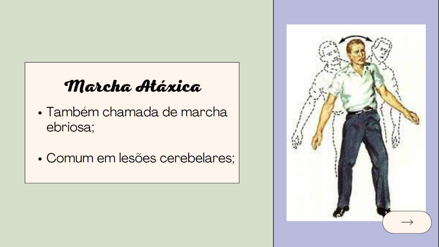 Marcha Atáxica