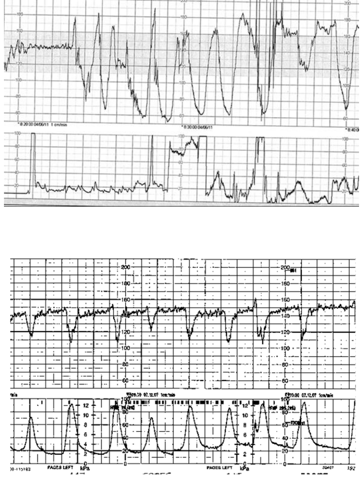 Cardiotocografia - Ginecologia e Obstetrícia