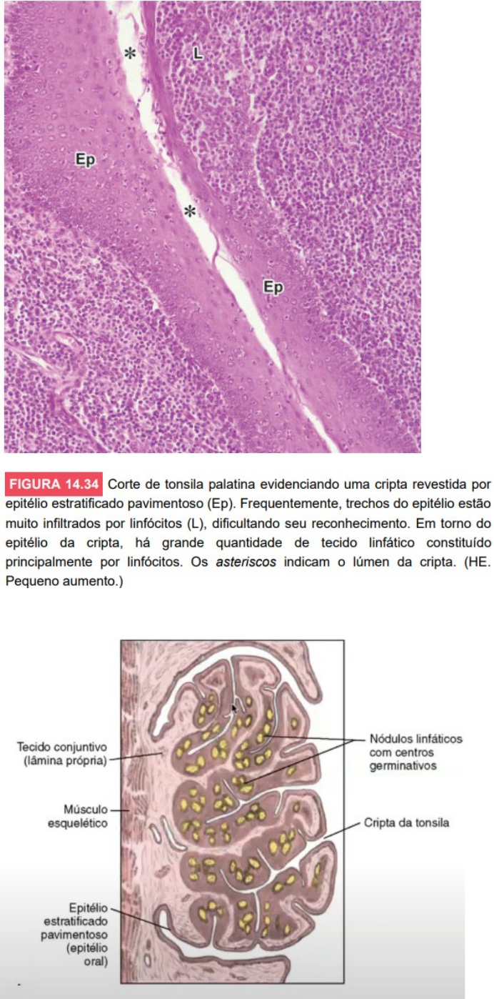 Histologia Das Tonsilas Linguais