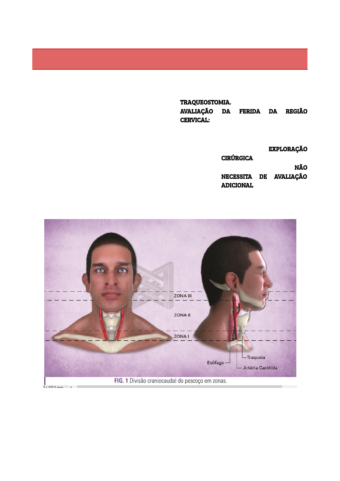TRAUMA DE PESCOÇO E FACE - Trauma