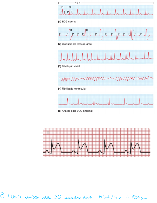 BASES FISICAS DO ELETROCARDIOGRAMA - Fisiologia Humana I