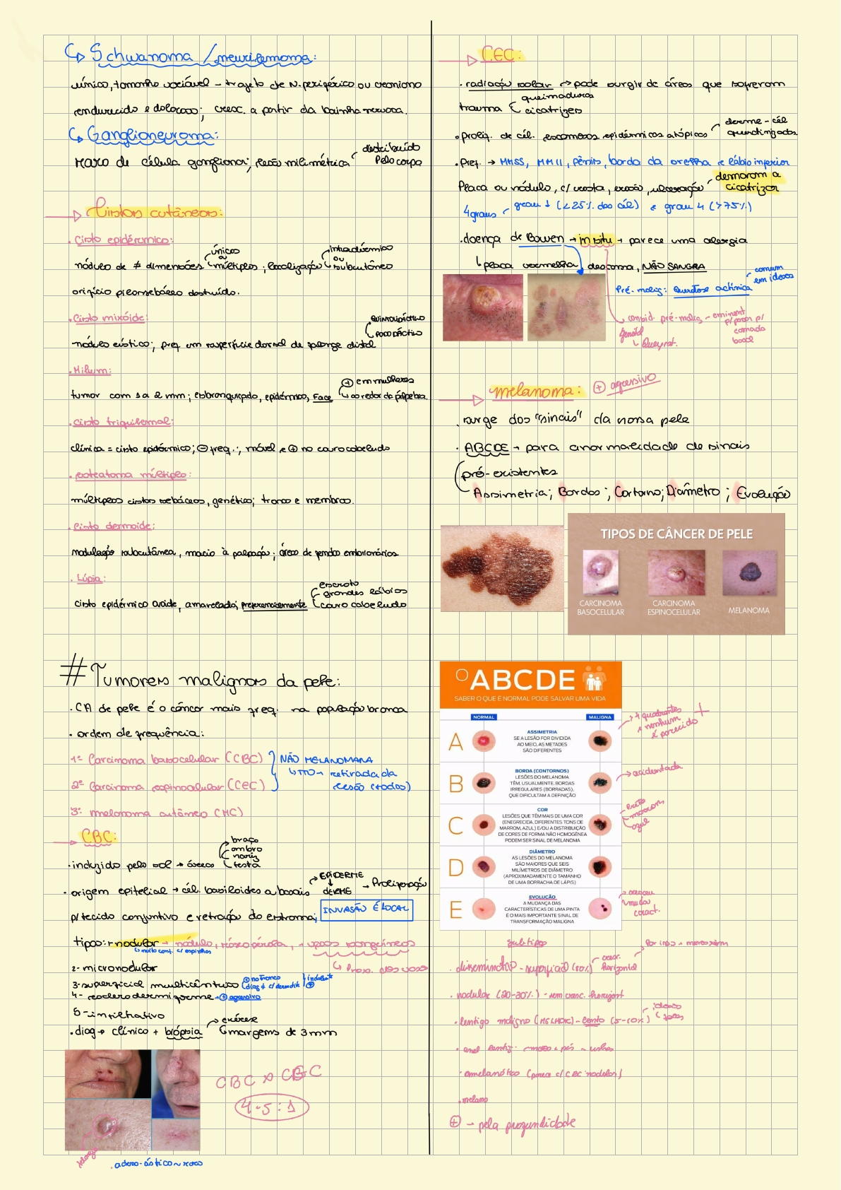 Neoplasia de pele - resumo - Dermatologia Neoplasia de pele - resumo - Dermatologia