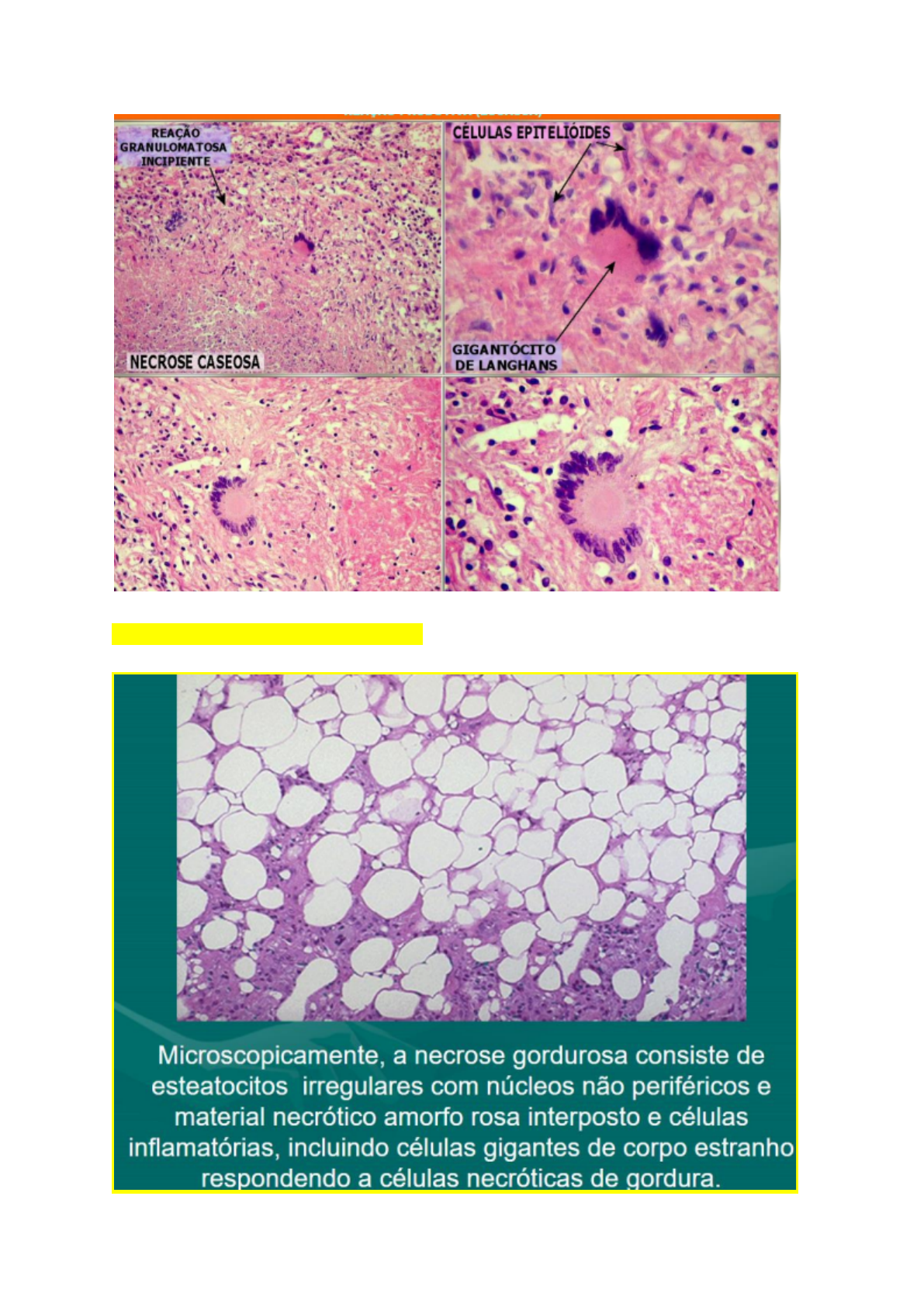 Morte Celular - Patologia Geral